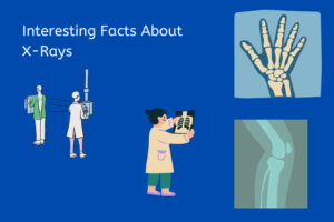 20 Interesting Facts About X-Rays | TL Dev Tech